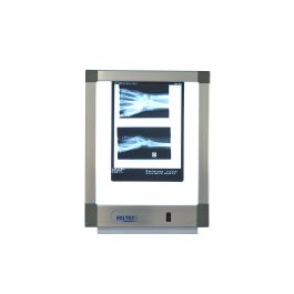 Negatoscopio standard con schermo singolo 54W a 141,31
