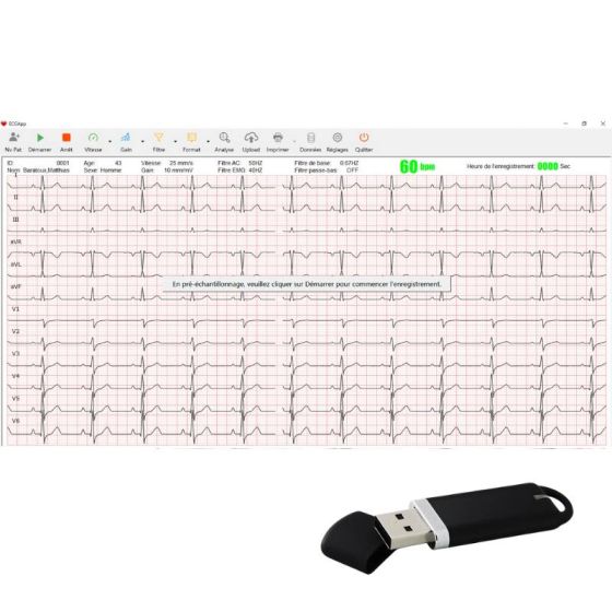 Software per ECG PC-ECG e Cardiomate 3, 6 e 12 Spengler